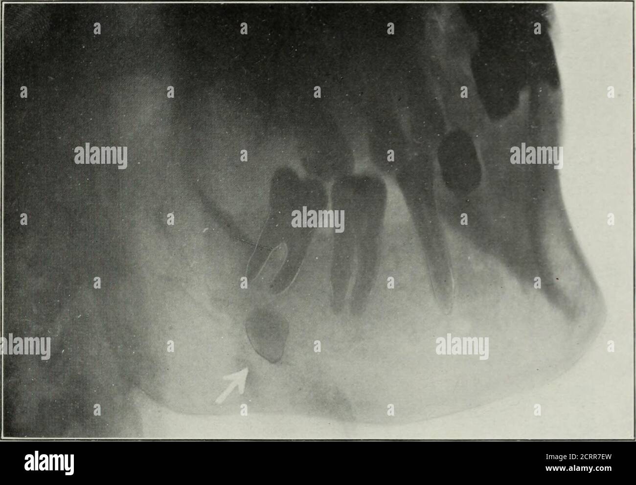Alveolar sac hi-res stock photography and images - Alamy