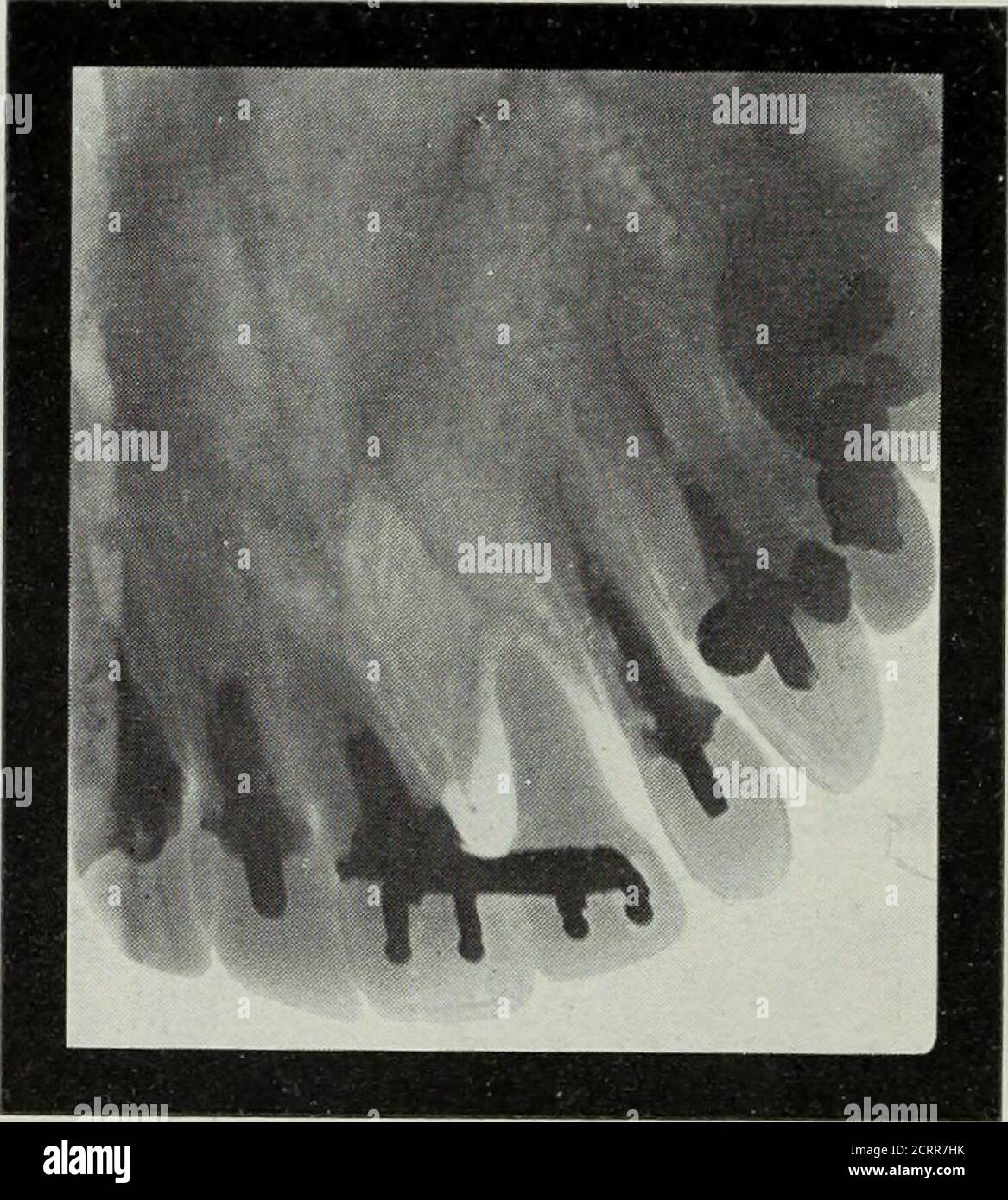. Elementary and dental radiography . Fig. 243. Fiff. 244. Fig. 243. A ...