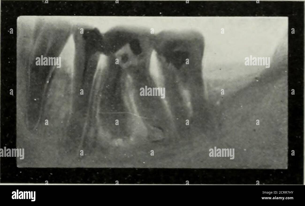 . Elementary and dental radiography . Fi-. ,Mii. Fig. 2-17. Fig. 246 ...