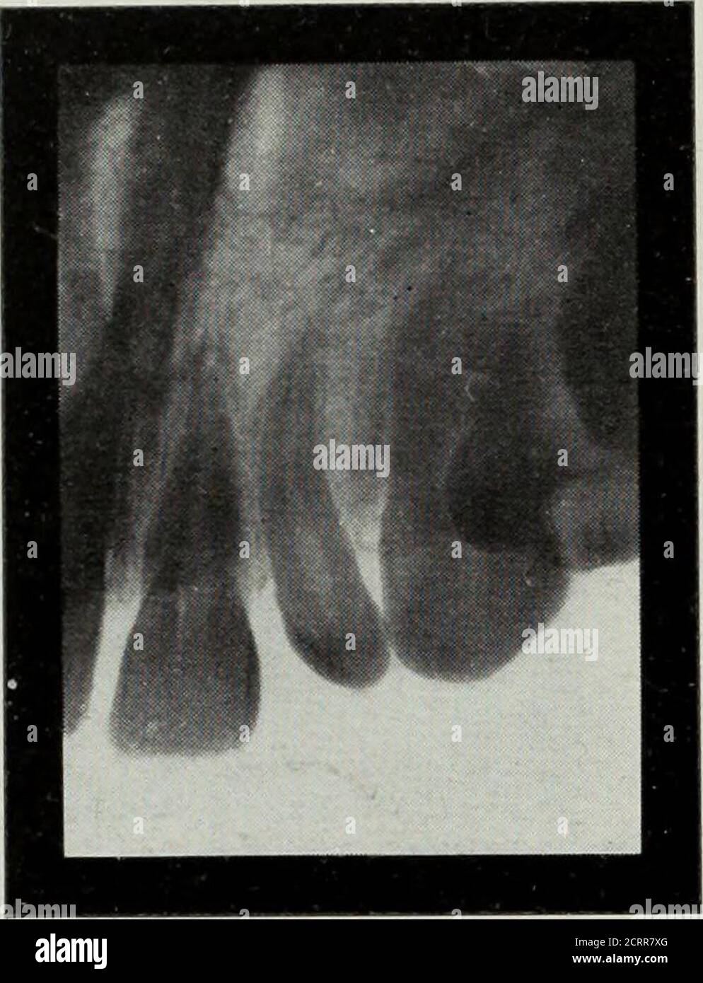 Peg shaped crown hi-res stock photography and images - Alamy