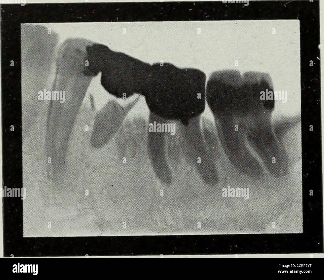 Examples of dental radiography hi-res stock photography and images - Alamy