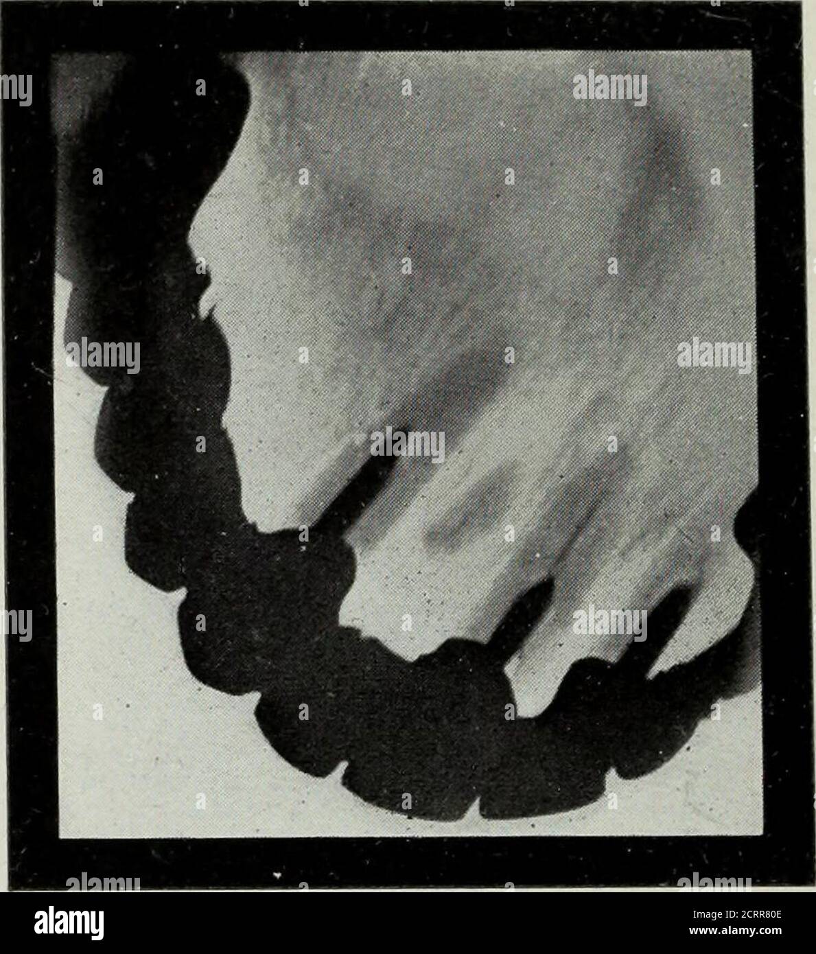 . Elementary and dental radiography . Fig. 239 Fig. 240 Fig. 239. A ...