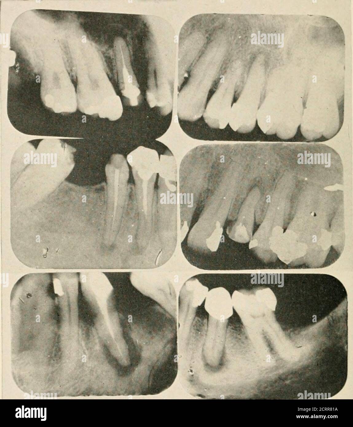 . Dental and oral radiography : a textbook for students and ...