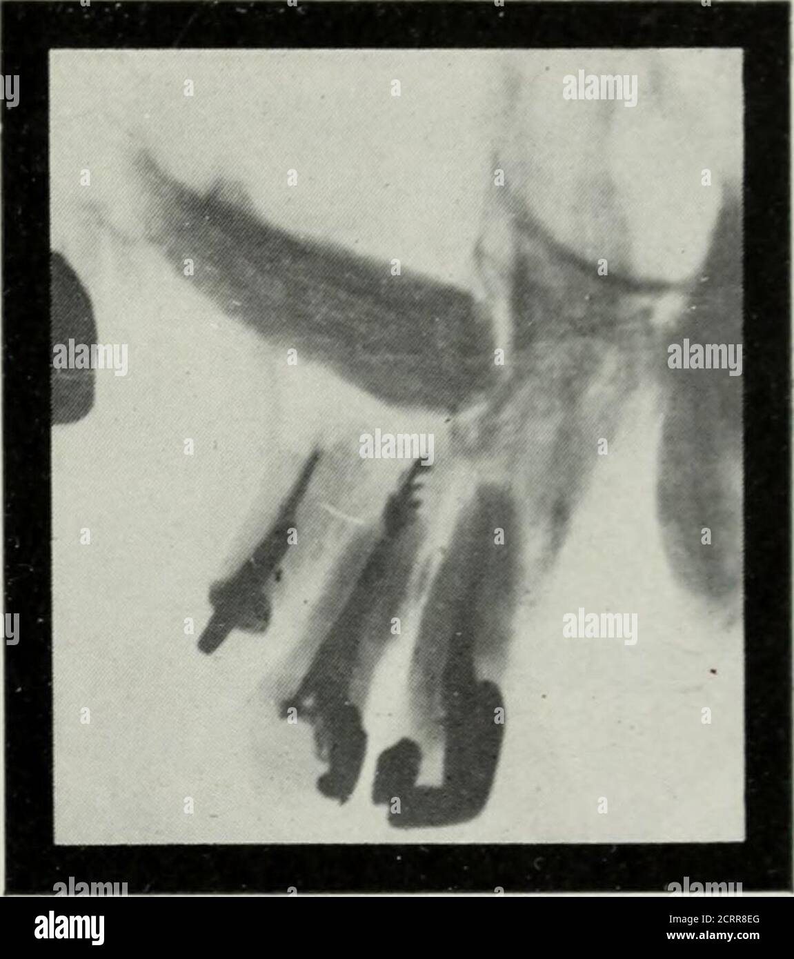 . Elementary and dental radiography . Fig. 209 Fig. 210 Fig. 209. An ...