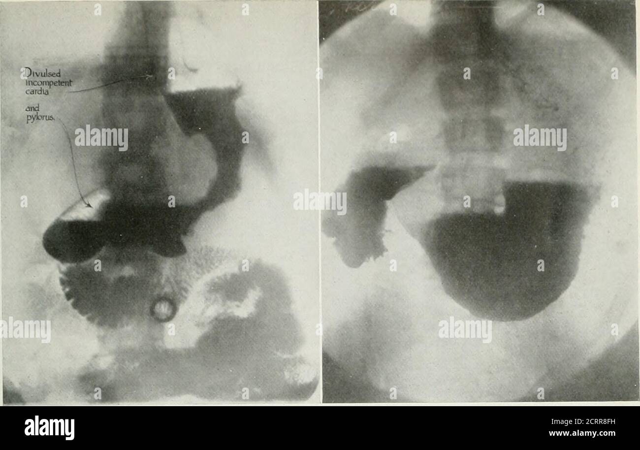 . The American journal of roentgenology, radium therapy and nuclear ...