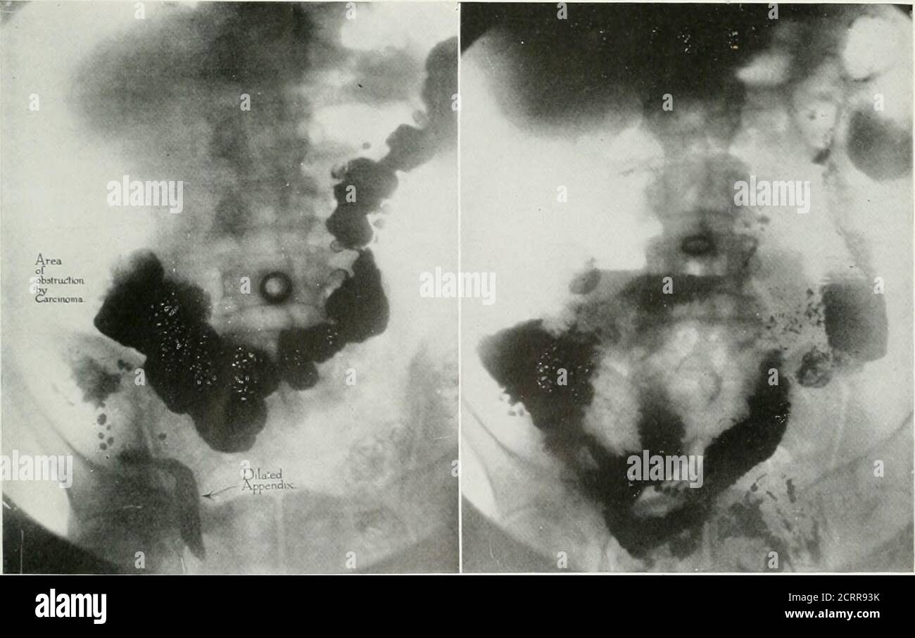. The American journal of roentgenology, radium therapy and nuclear ...