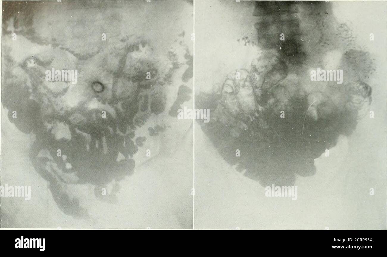 Asthenic hi-res stock photography and images - Alamy