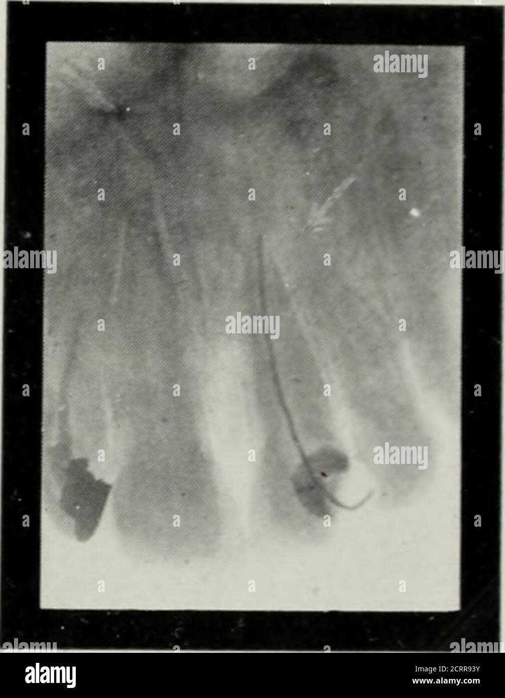 Canal 195 hi-res stock photography and images - Alamy