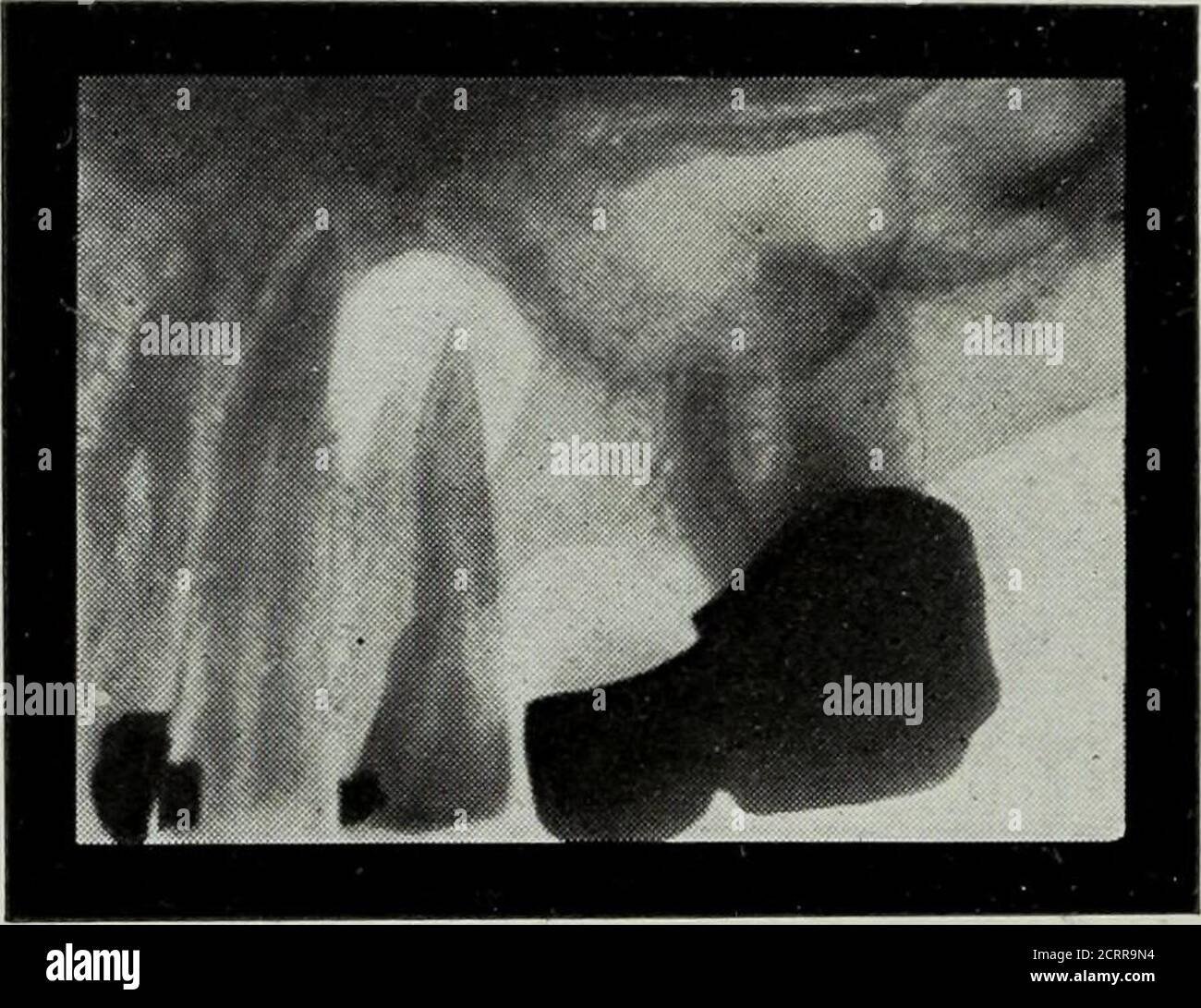 . Elementary and dental radiography . Fig. 191 Fig. 192 Fig. 191. Both ...