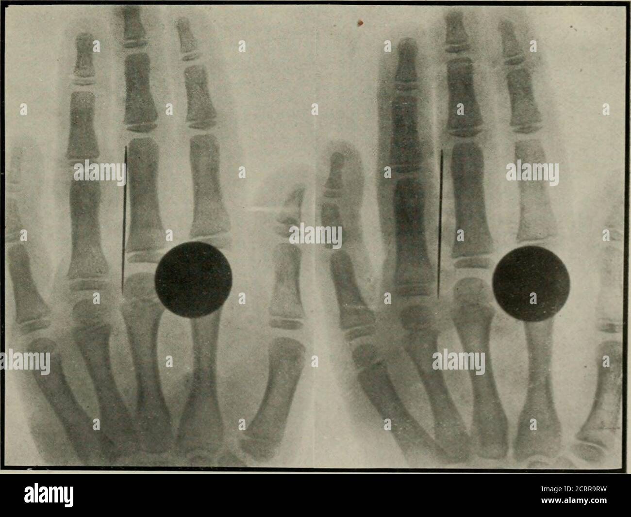 Coin radiography hi-res stock photography and images - Alamy