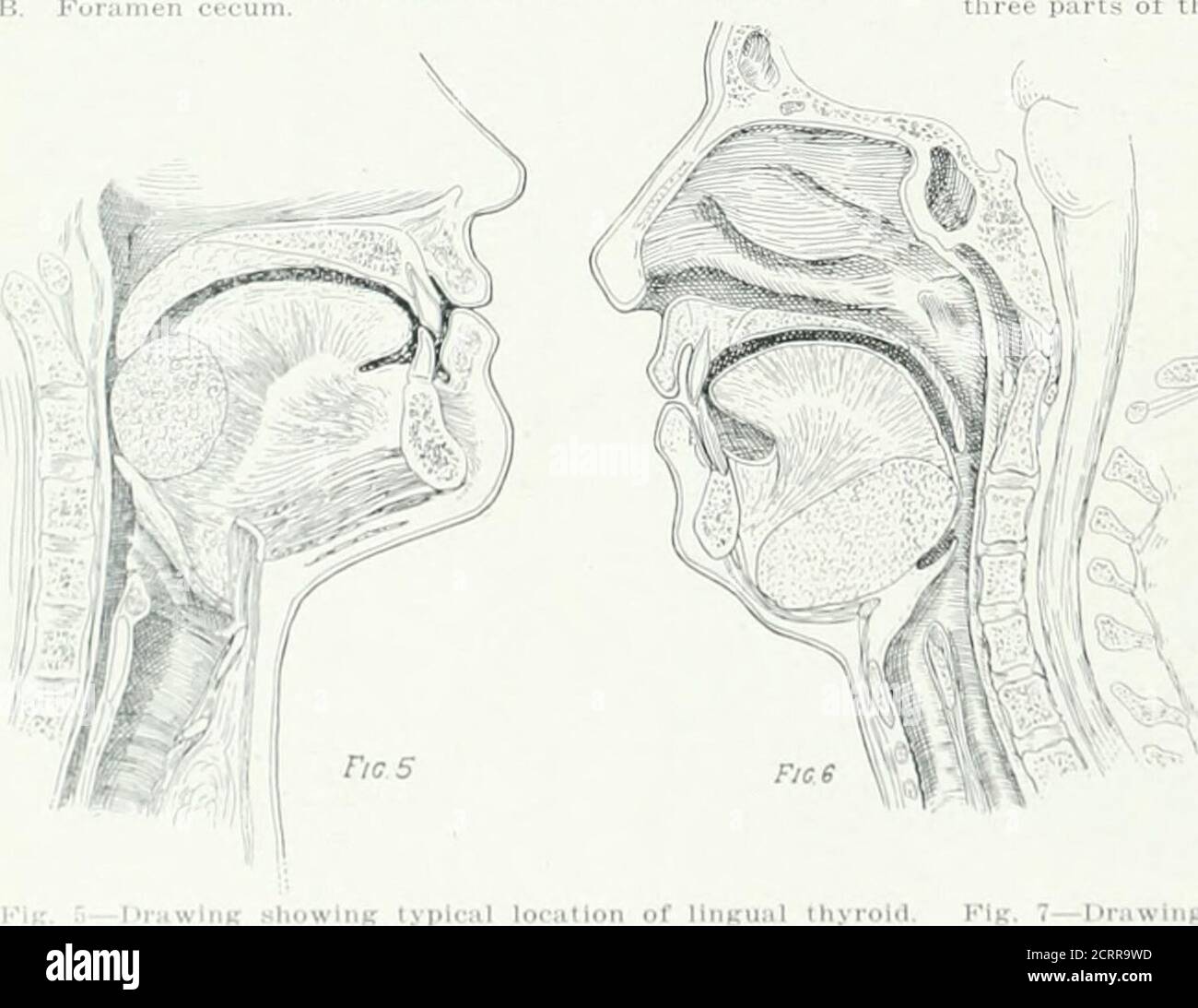 What Is Foramen Cecum