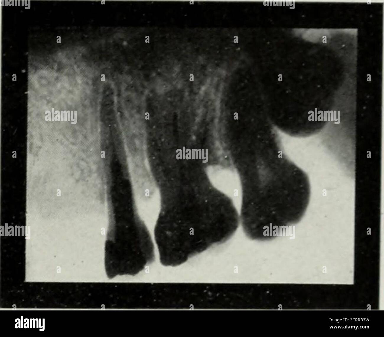 . Elementary and dental radiography . Fig. 160. Fig. 161. Fig. 160 ...
