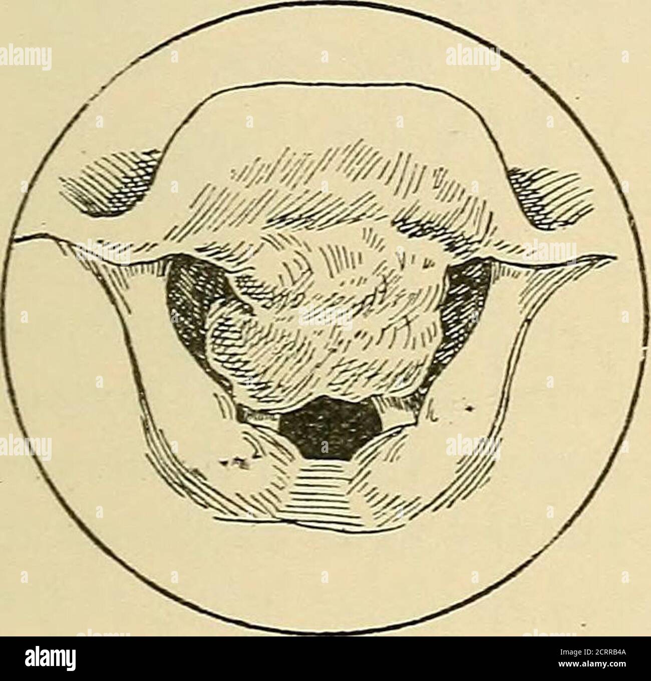 . Diseases of the nose and throat . respiration and phonation. In ...