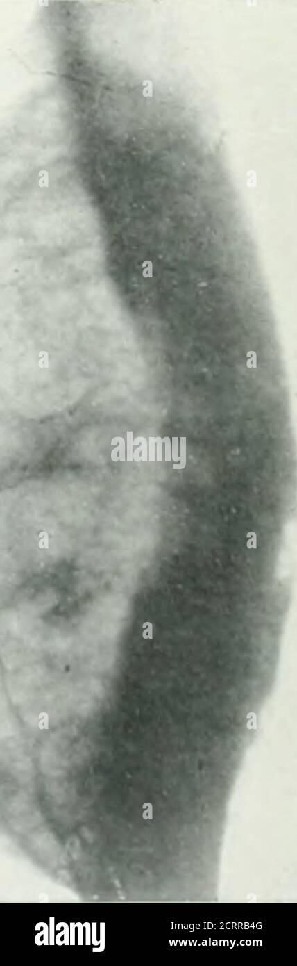 . Archives of physical medicine and rehabilitation . •lg^. 7 and S ...