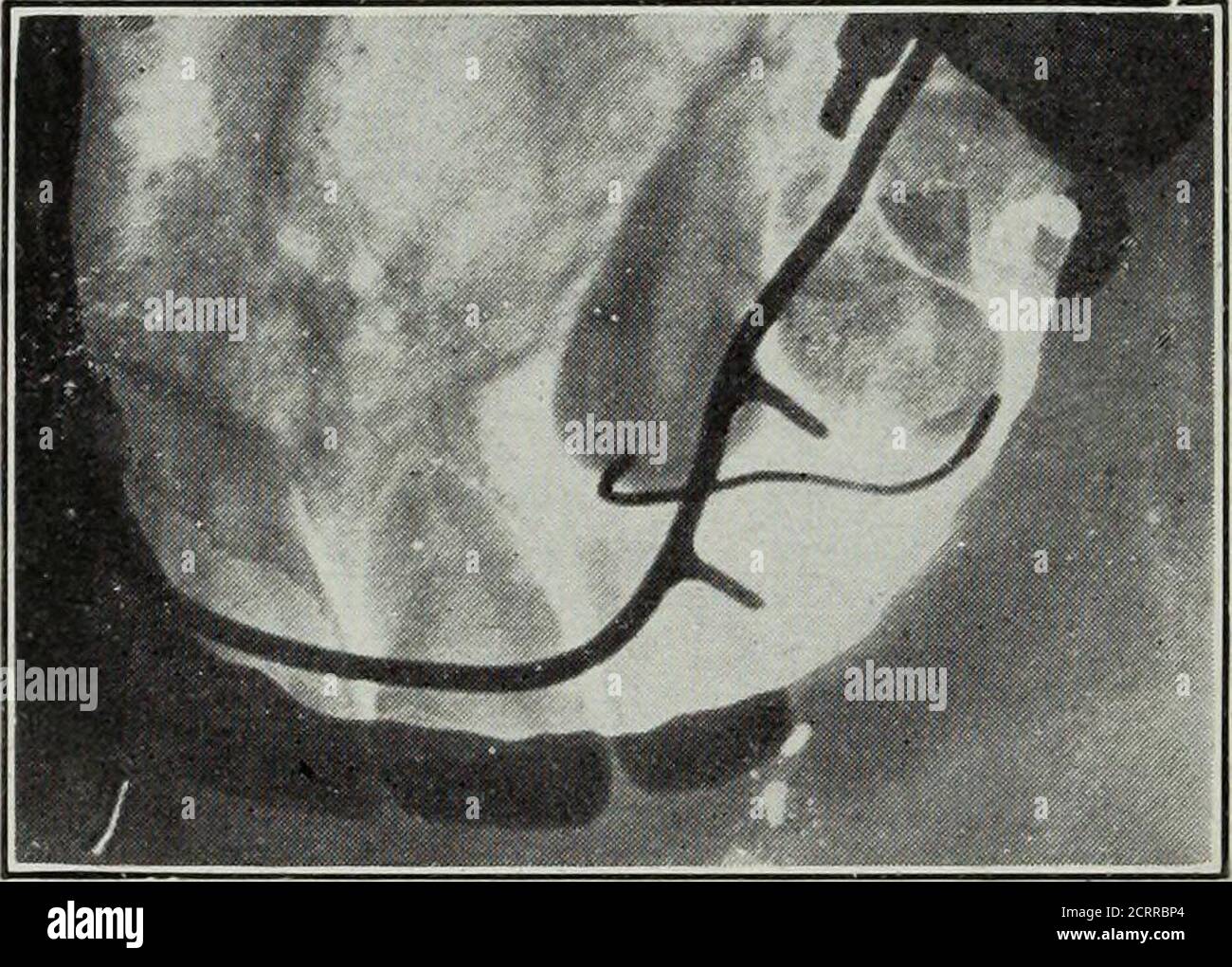 . Elementary and dental radiography . Fig. 150. Fig. 151. Fig. 150 ...