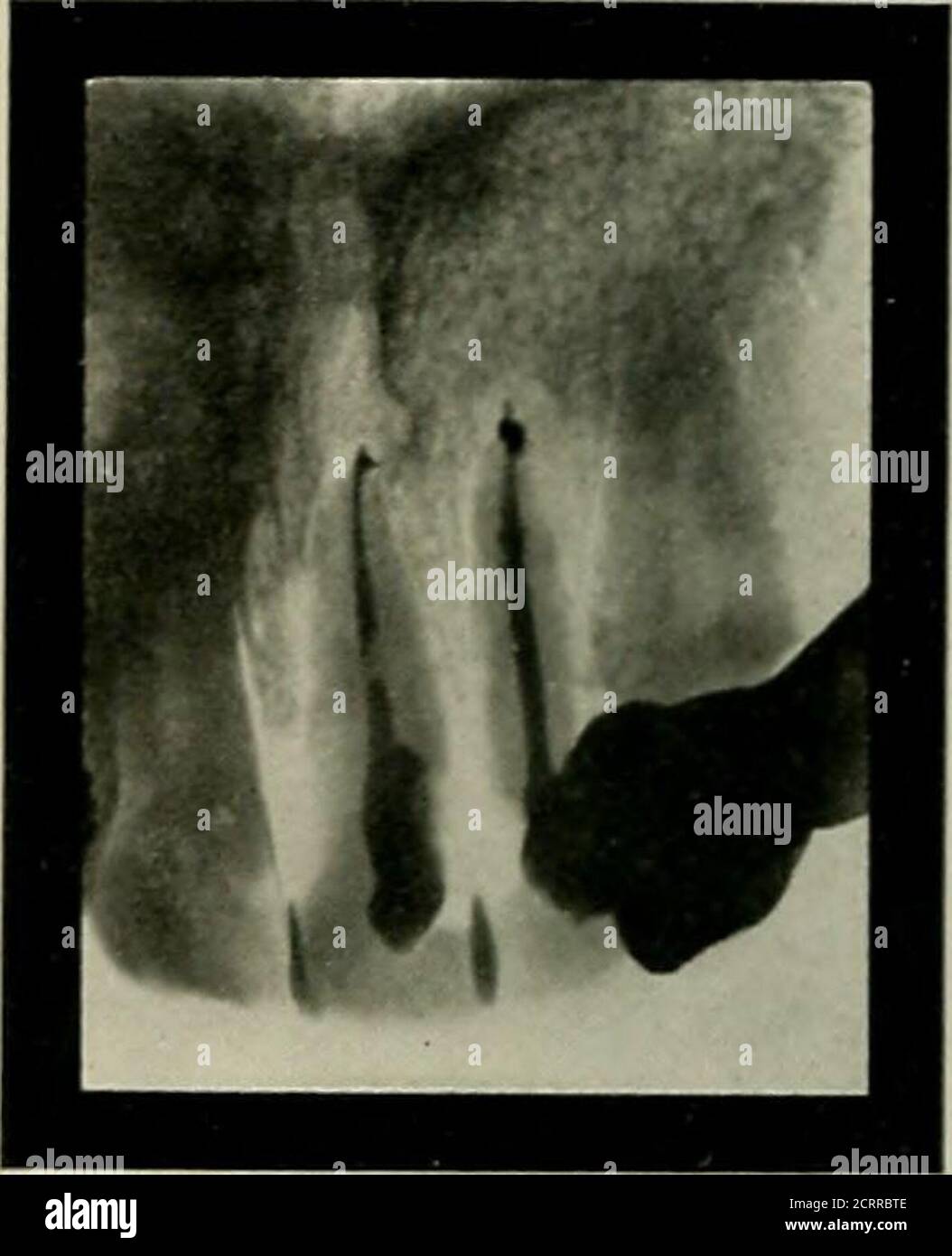 . Elementary and dental radiography . Fig. 300. Fig. 301. Fig. 300 ...