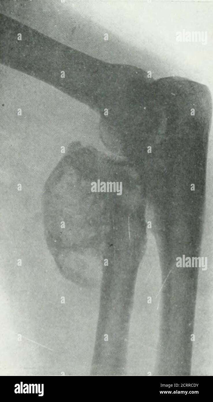 . Archives of physical medicine and rehabilitation . 12—Osteogenic ...