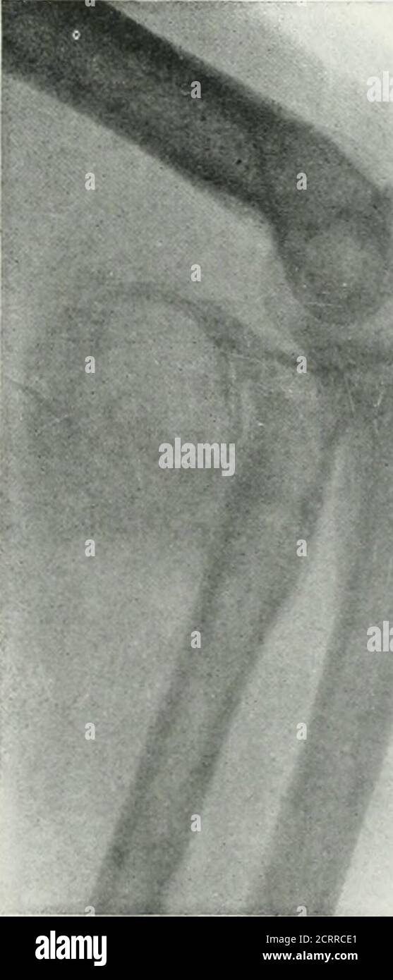 . Archives of physical medicine and rehabilitation . iiethod of ...