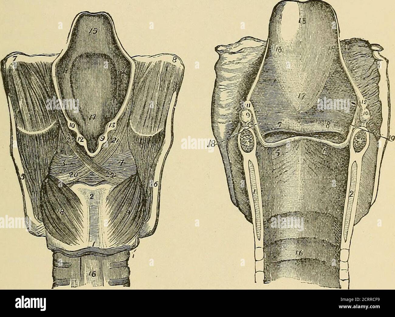 . Diseases of the nose and throat . Fig. 100.—The cricothyroid muscle ...