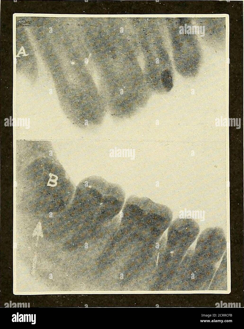 . Practical electro-therapeutics and X-ray therapy : with chapters on ...