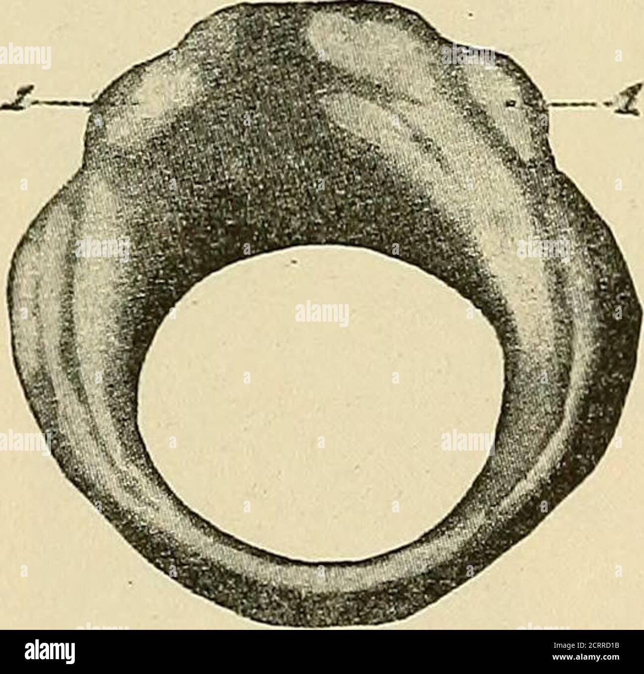 . Diseases of the nose and throat . Fig. 98.—The cricoid, seen ...