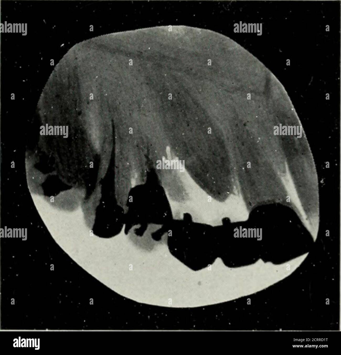 . Elementary and dental radiography . Fig. 128. Congenital absence of ...