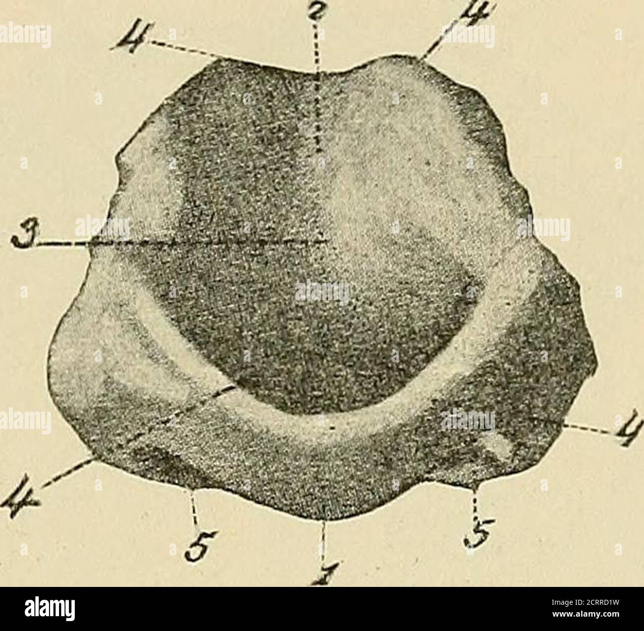 . Diseases of the nose and throat . Fig. 97.—The cartilaginous frame of ...