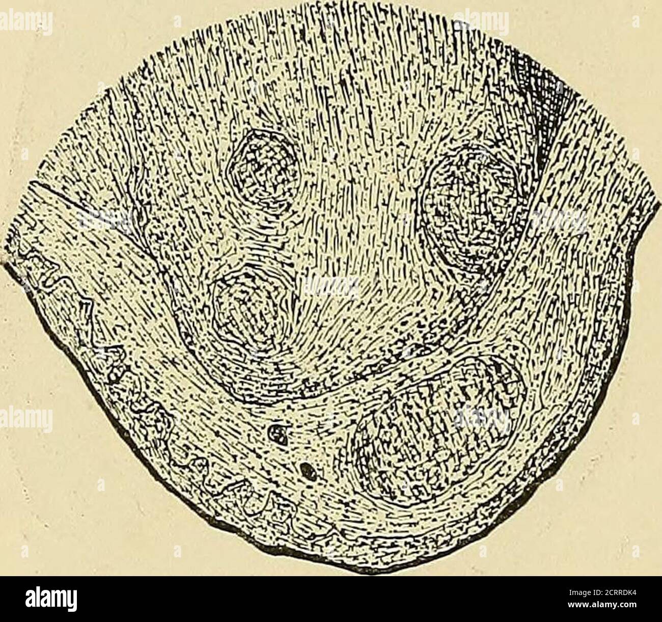 . Diseases of the nose and throat . r in this, as in otherhypertrophies ...