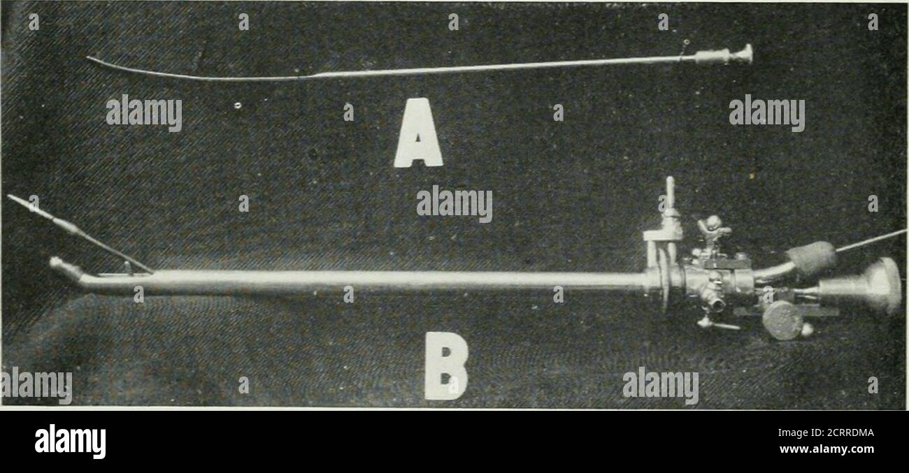 . Radium . Fig. 3.—Shows diagramalicalbthe radium needles inserted ...