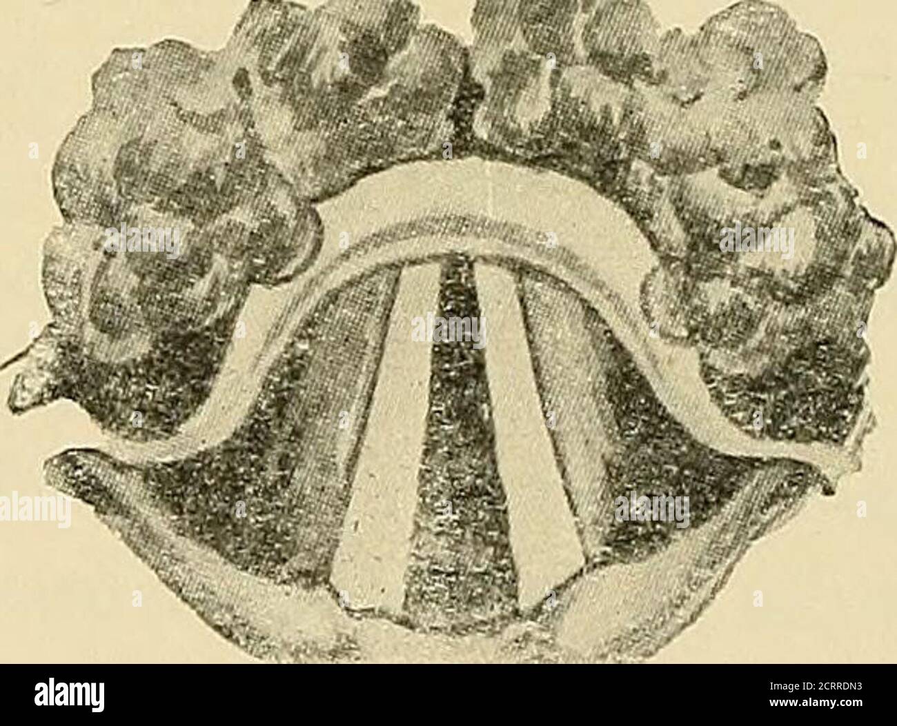 Lingual tonsil hi-res stock photography and images - Alamy