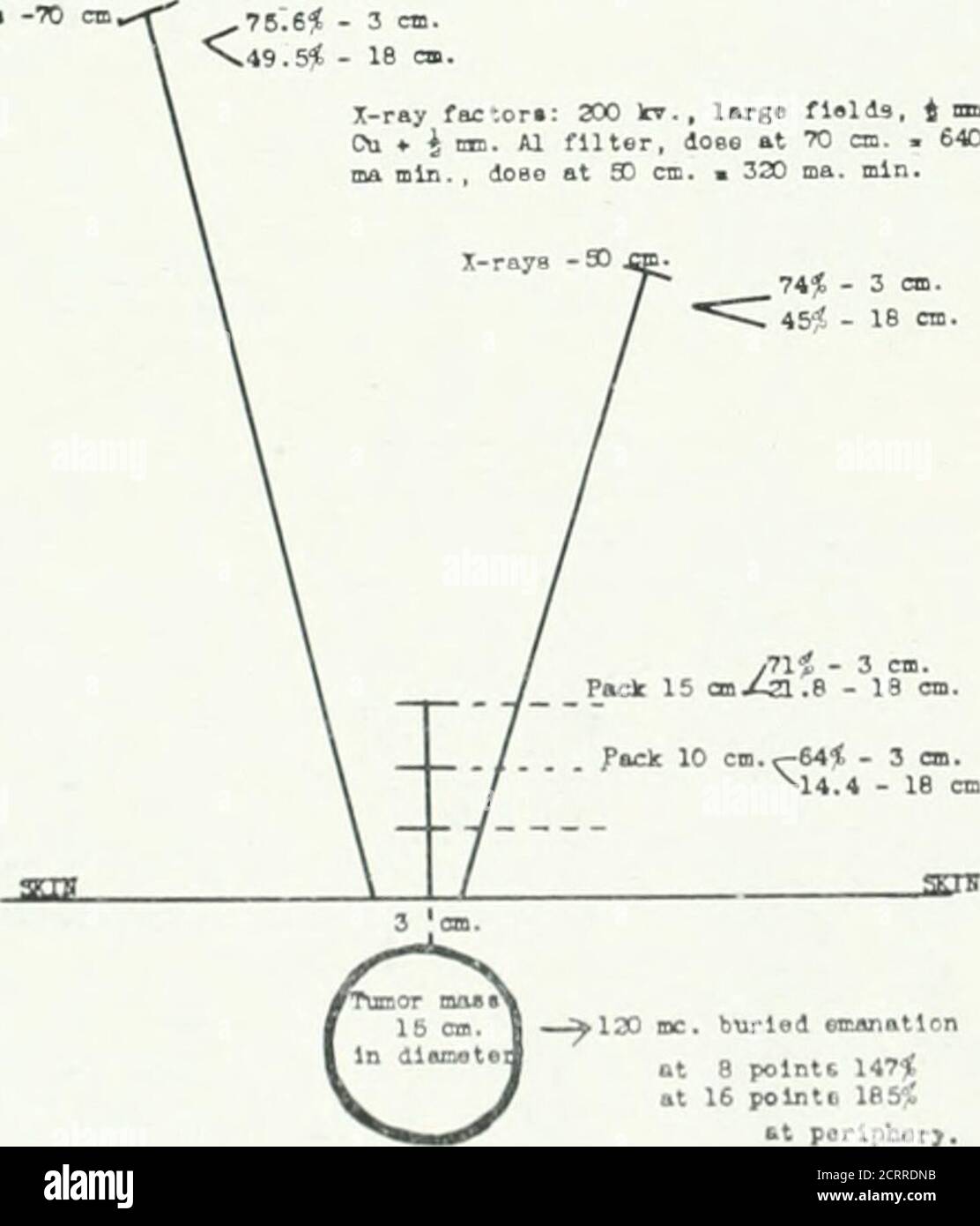 . Archives of physical medicine and rehabilitation . ed radium ...
