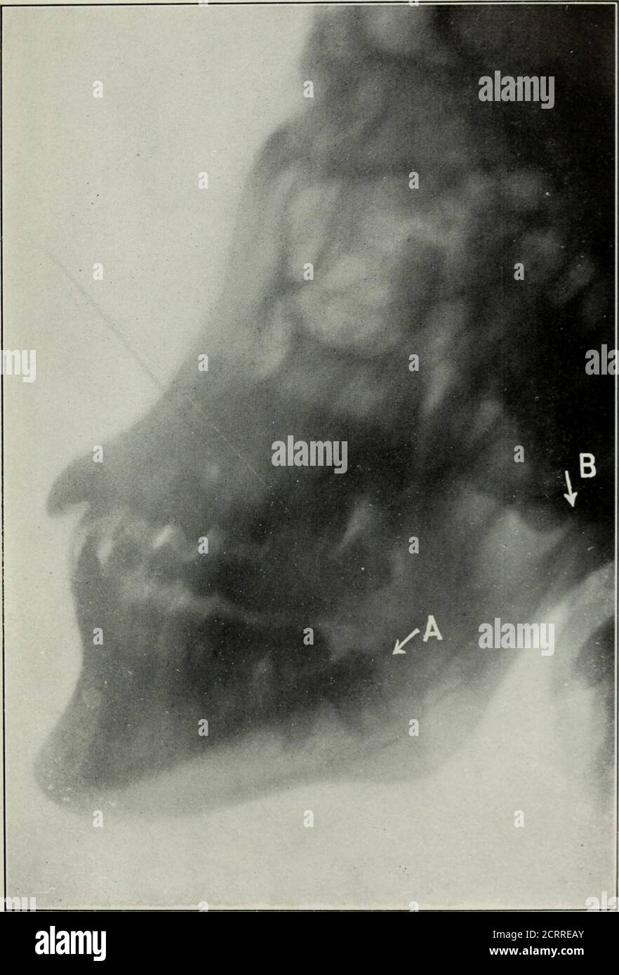 Potassium Intensifies