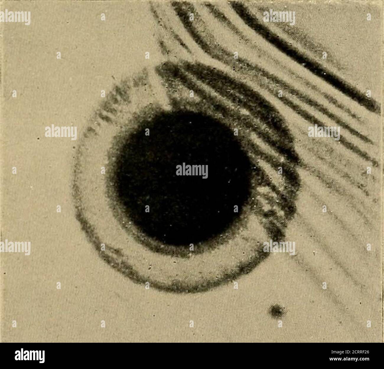 X 35 diameters hi-res stock photography and images - Alamy