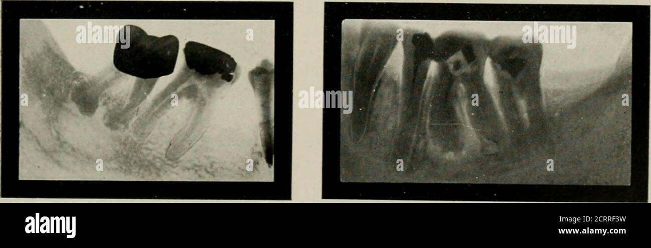 Cementoma hi-res stock photography and images - Alamy