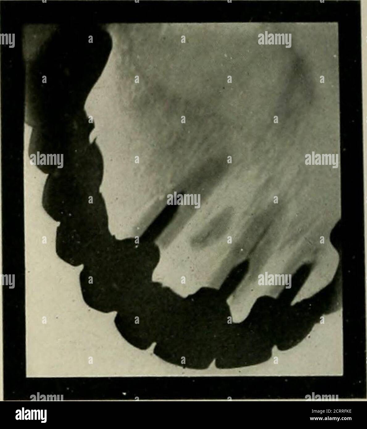 . Elementary and dental radiography . Fig. 239 Fig. 240 Fig. 239. A ...