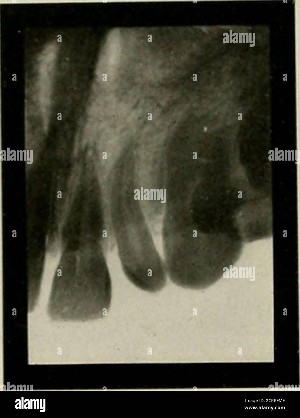 Peg teeth hi-res stock photography and images - Alamy