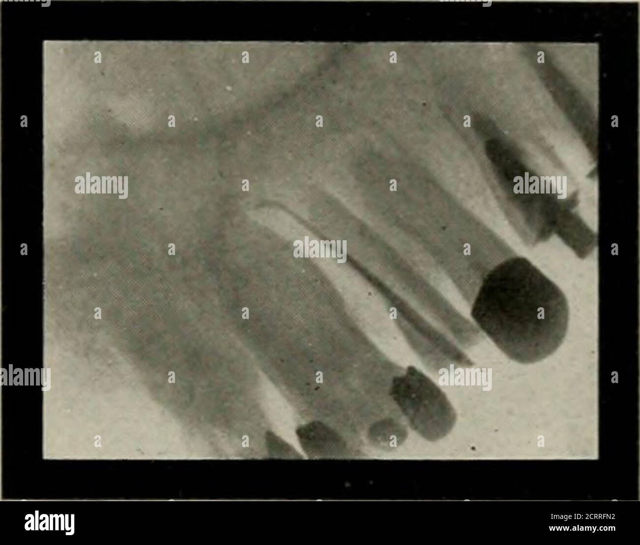 . Elementary and dental radiography . Fig. 237 Fig. 238 Fig. 237. The ...