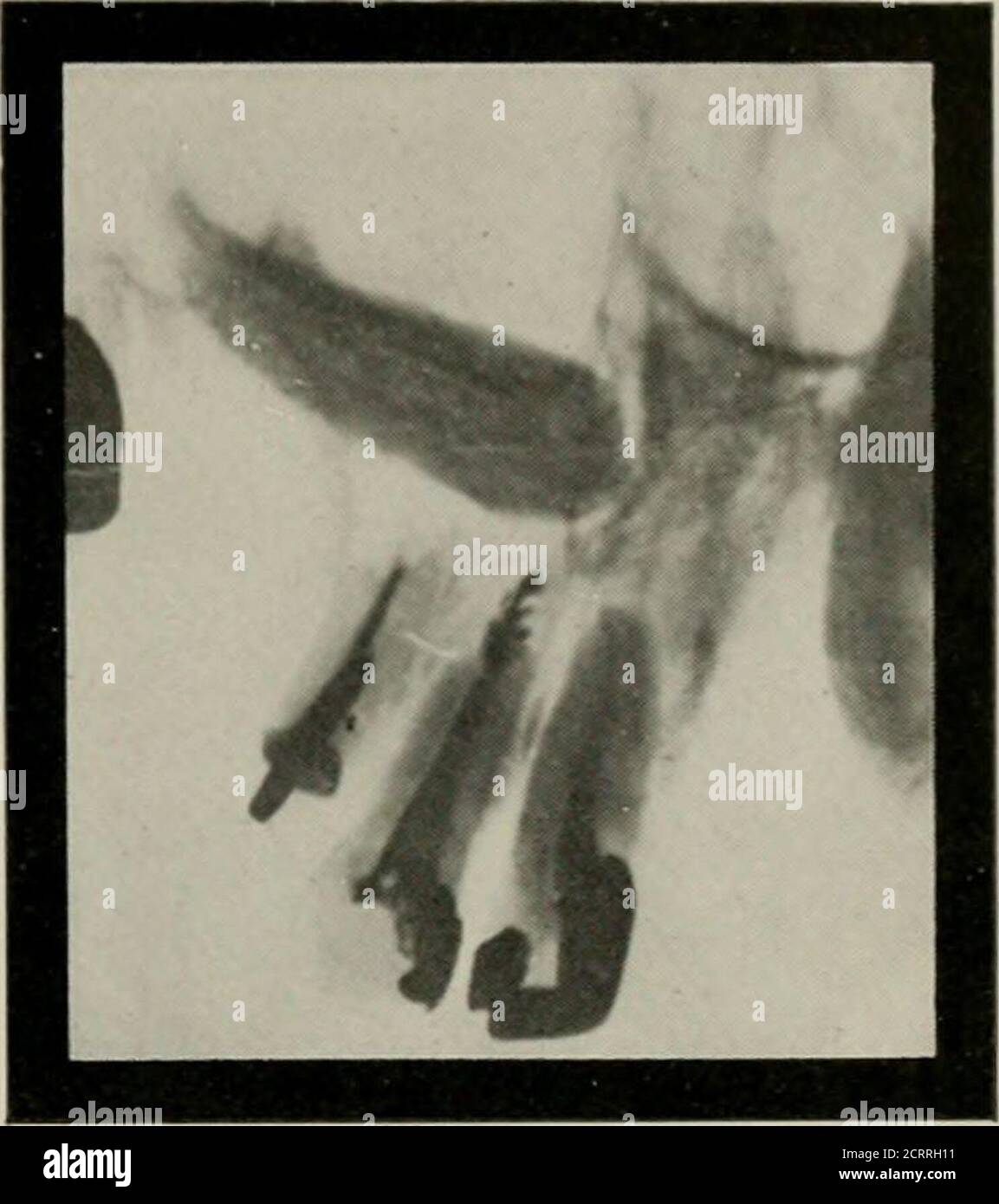 . Elementary and dental radiography . Fig, 809 Fig. 210 Fig. 209. An ...