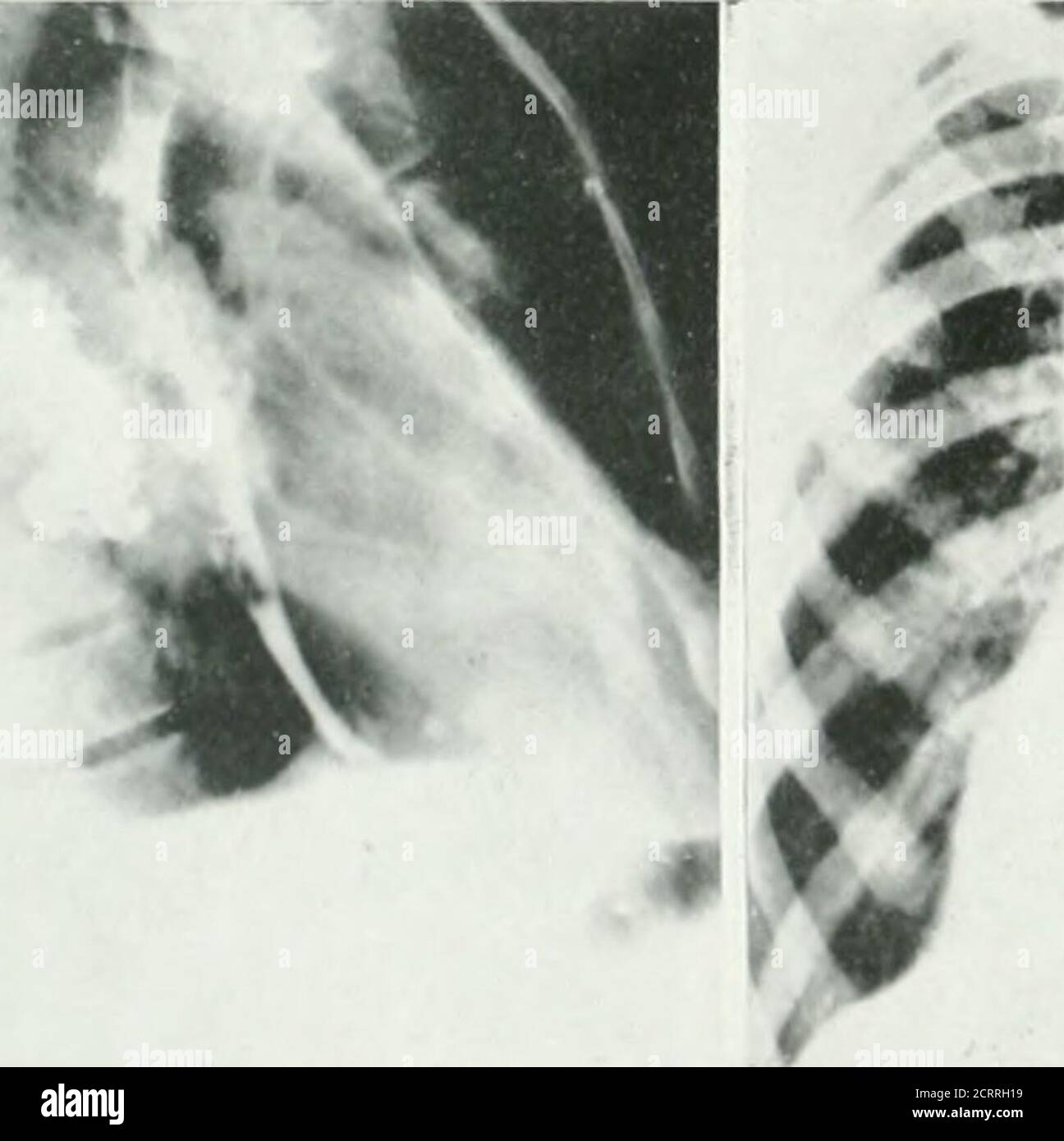 . Archives of physical medicine and rehabilitation . Fig 10—Iiiuig ...