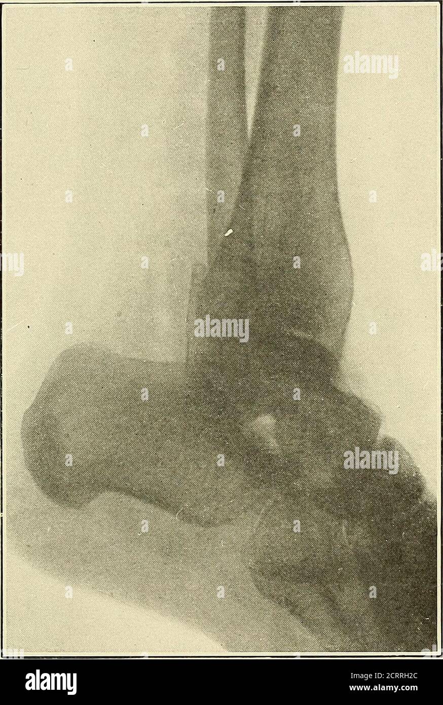 . Practical electro-therapeutics and X-ray therapy : with chapters on ...