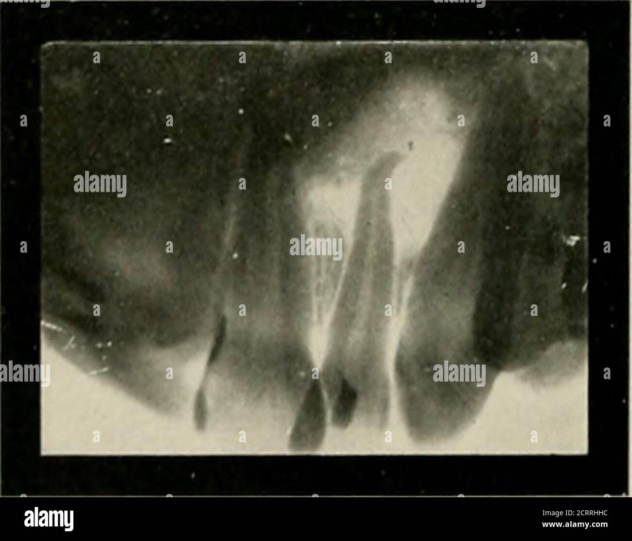 . Elementary and dental radiography . Fig. 201 Fig. 201 Fig. 200 ...