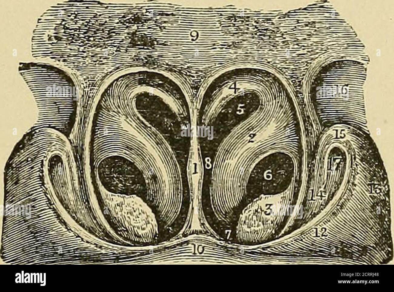 . Diseases of the nose and throat . and the antra of Highmore ...