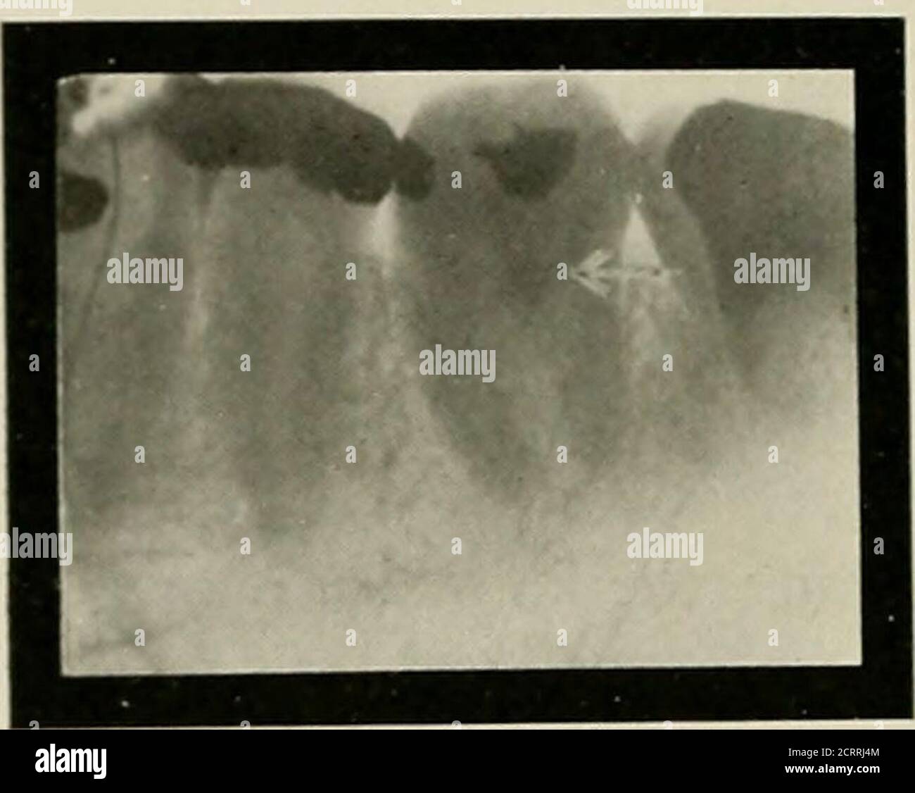 Great tig hi-res stock photography and images - Alamy