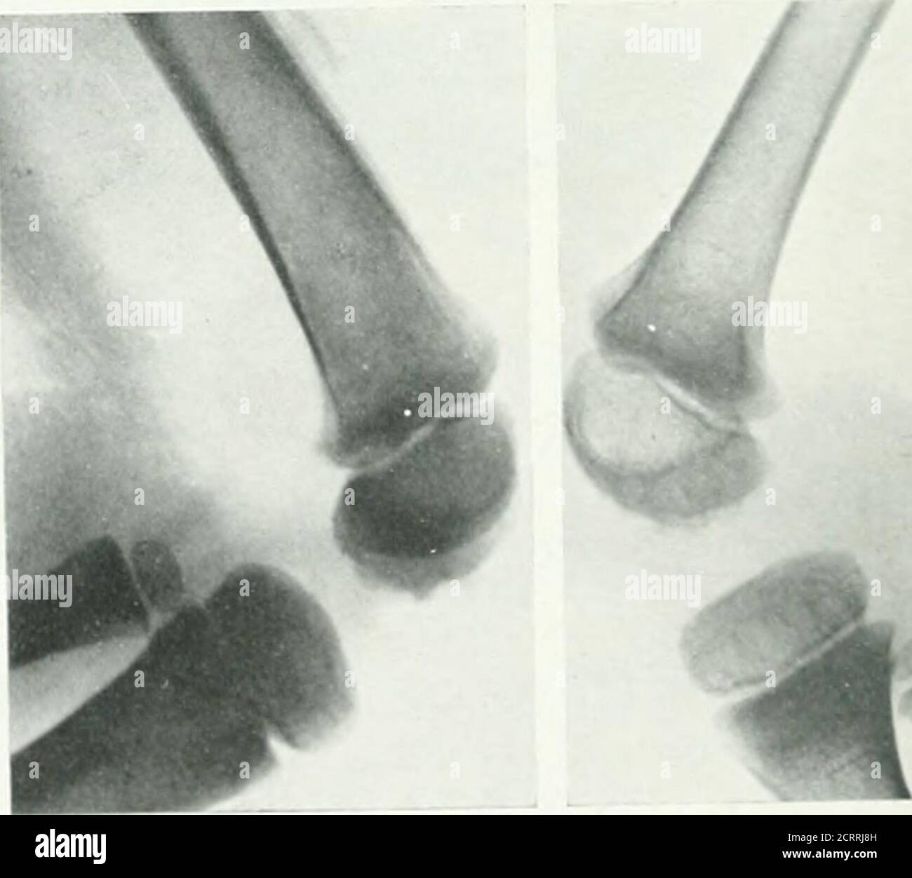 . Archives of physical medicine and rehabilitation . pig^. 2-a Lateral ...