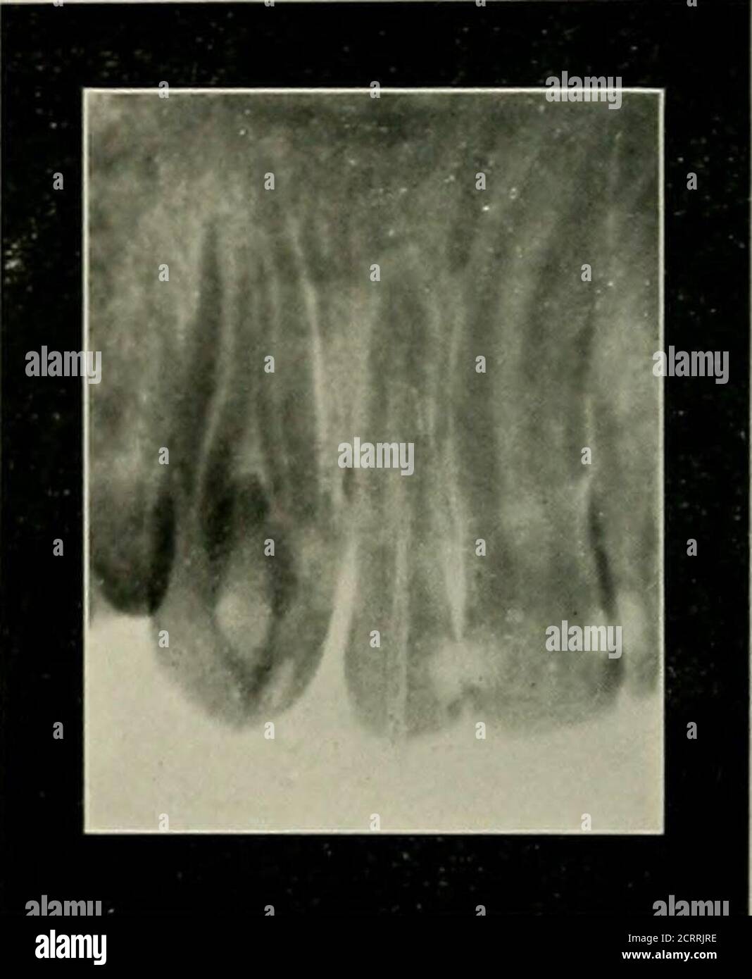 . Elementary and dental radiography . Fig. 155. Fig. 156. Fig. 155. An ...