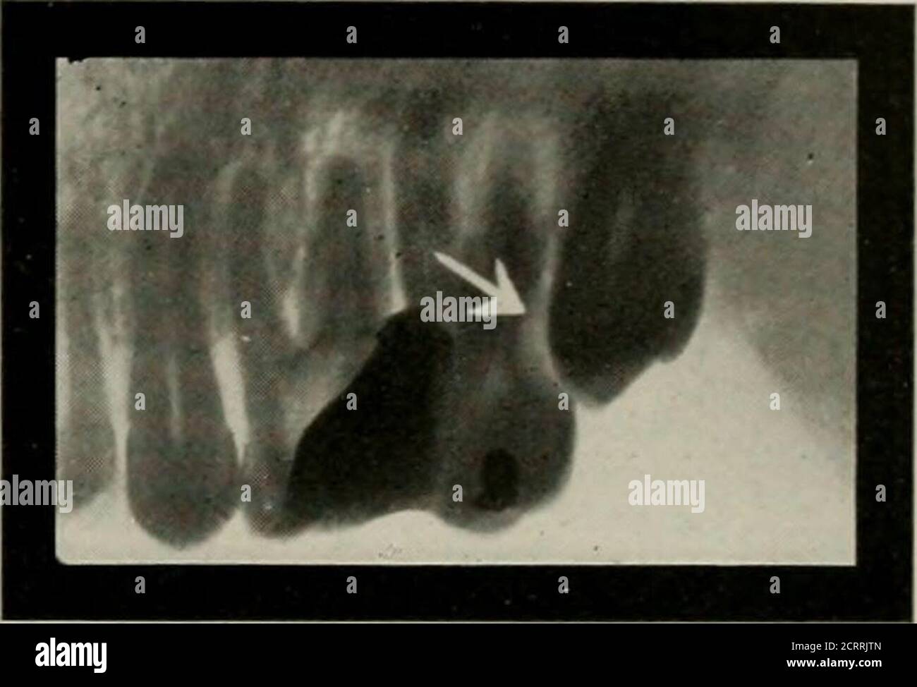 . Elementary and dental radiography . Fig. 157. Fig. 158. Fig. 157. An ...