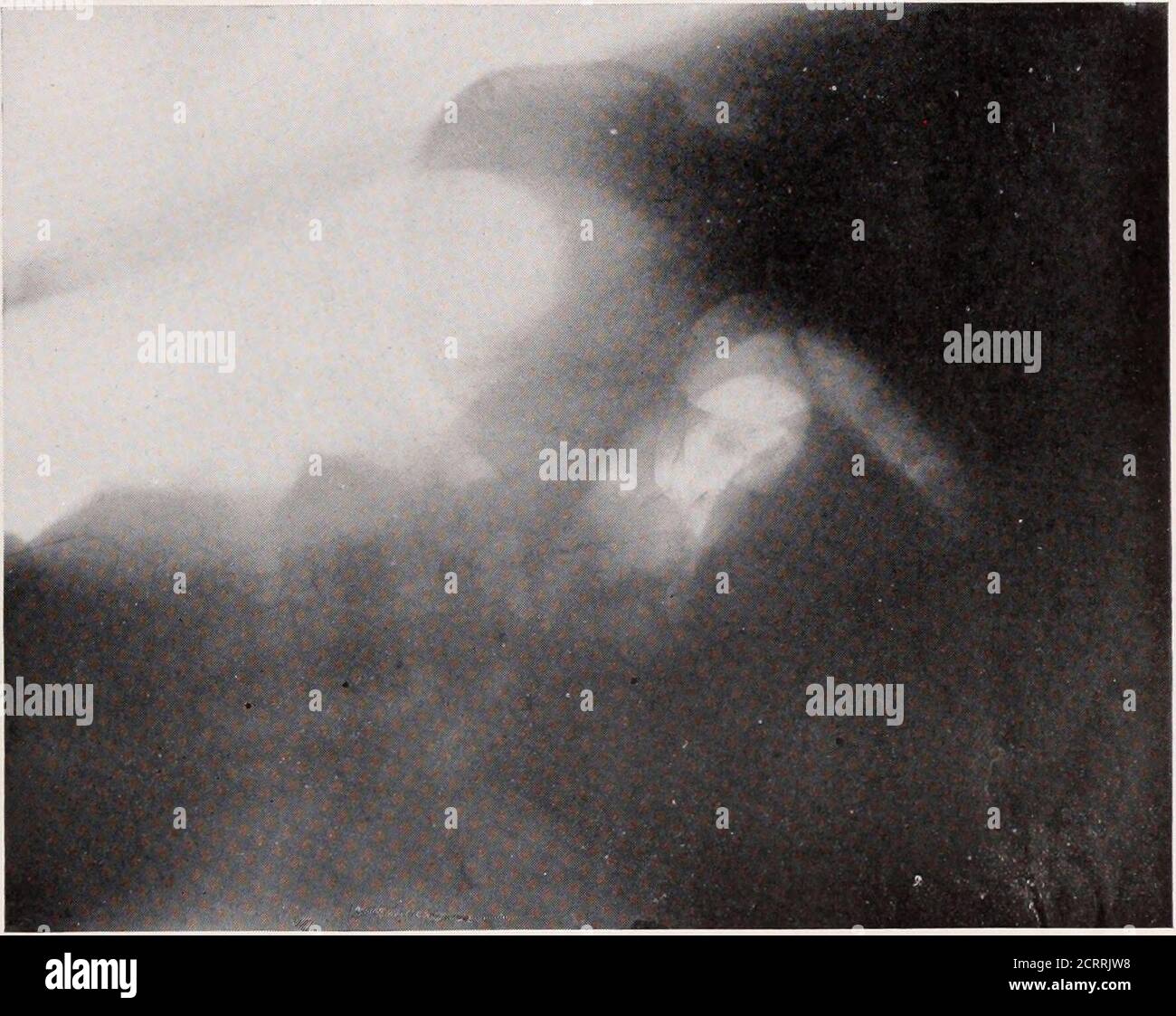 . Journal of radiology . Case 21. No. 3630The illustration is lateral ...