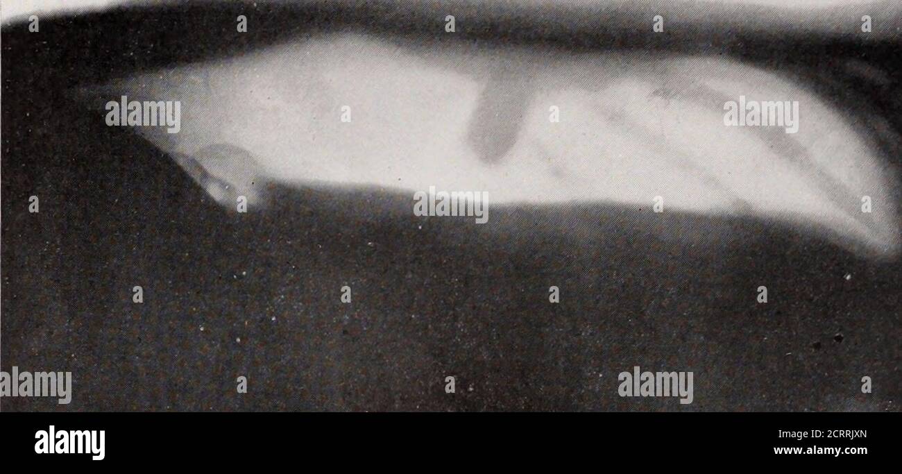 . Journal of radiology . hysical examination shows no finding of ...