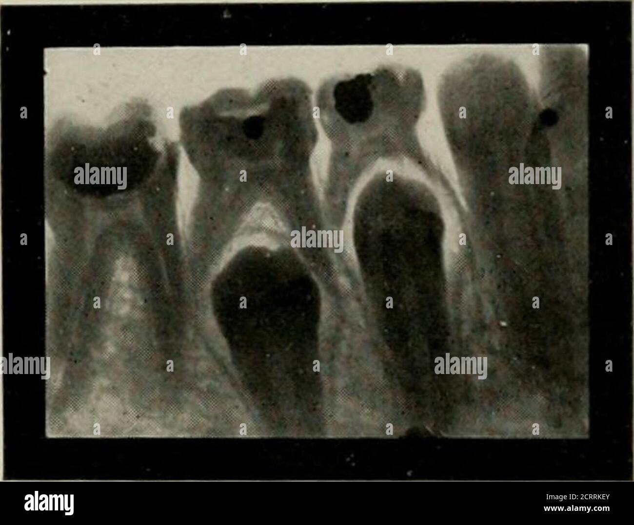 . Elementary and dental radiography . d condition, or because of ...