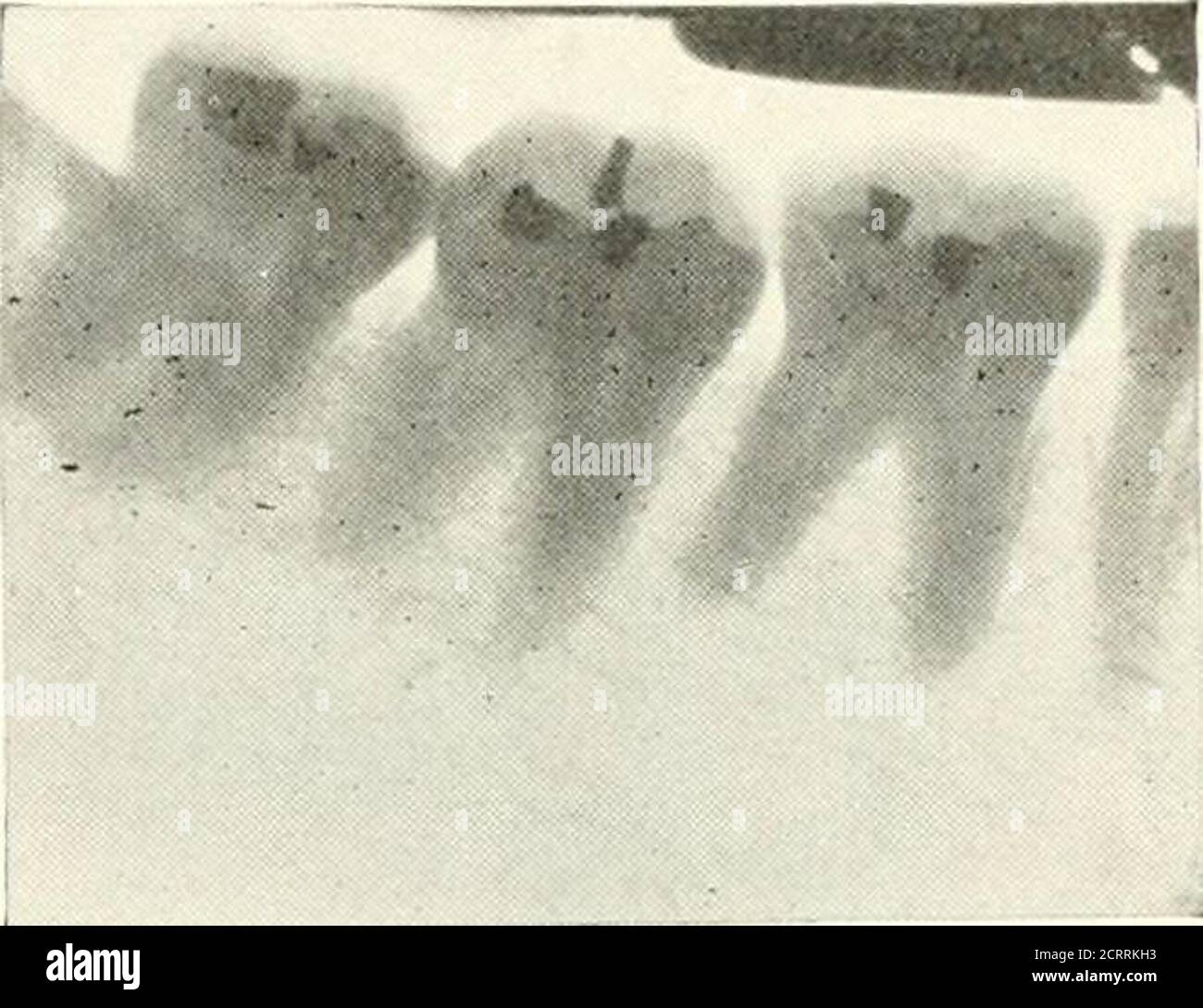 Pulp stones hi-res stock photography and images - Alamy